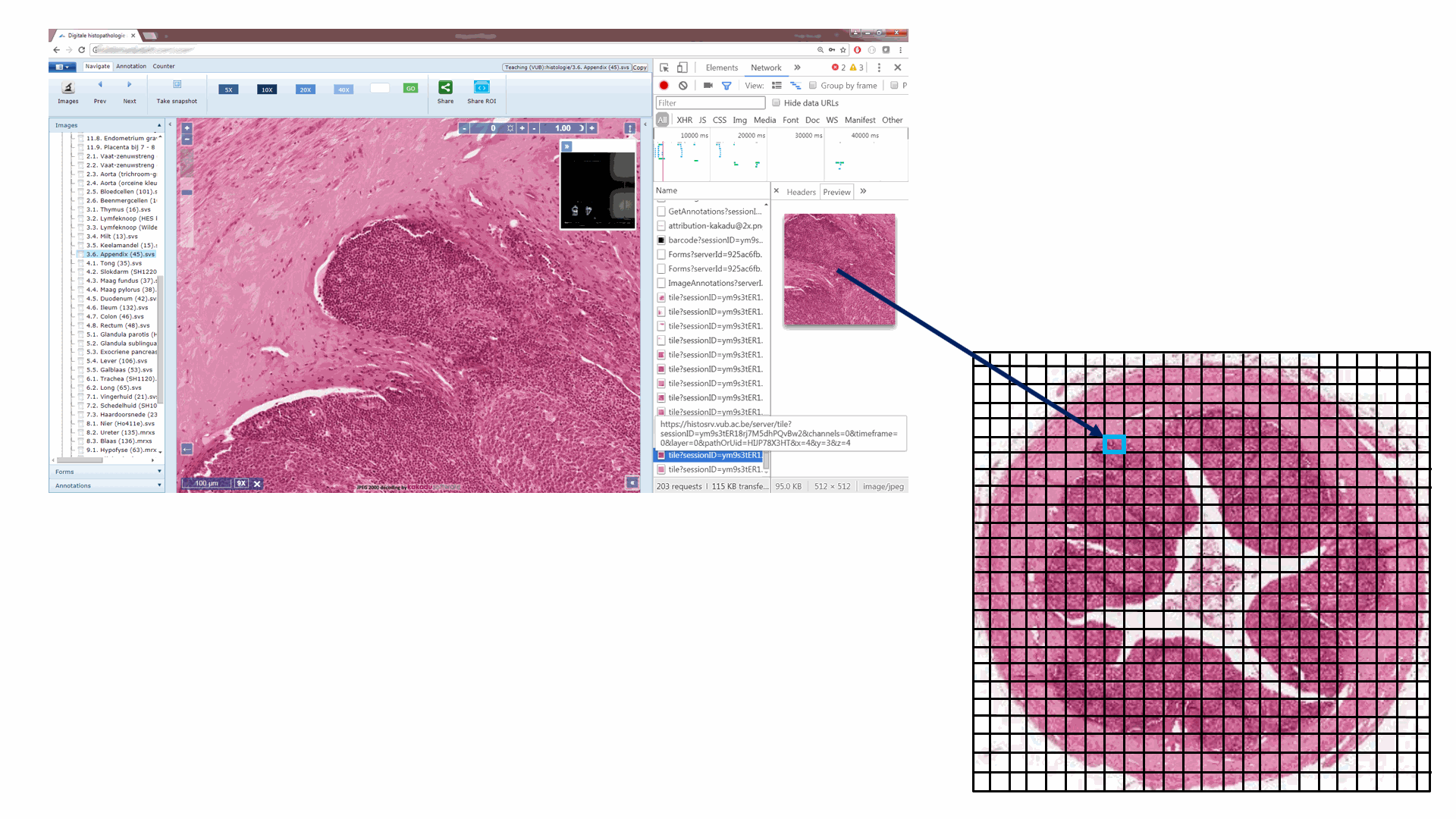 What whole slide images (WSIs) are made of – Real Data Digital Pathology blog